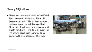 recent development in artificial.liver. in field of biomedical engineering | PPTX