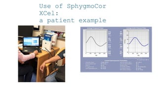 Non-Invasive assessment of arterial stiffness in advanced heart failure ...