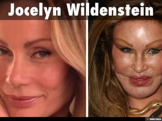 The Best of the Botched | PDF