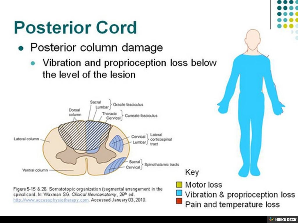 Posterior cord syndrome