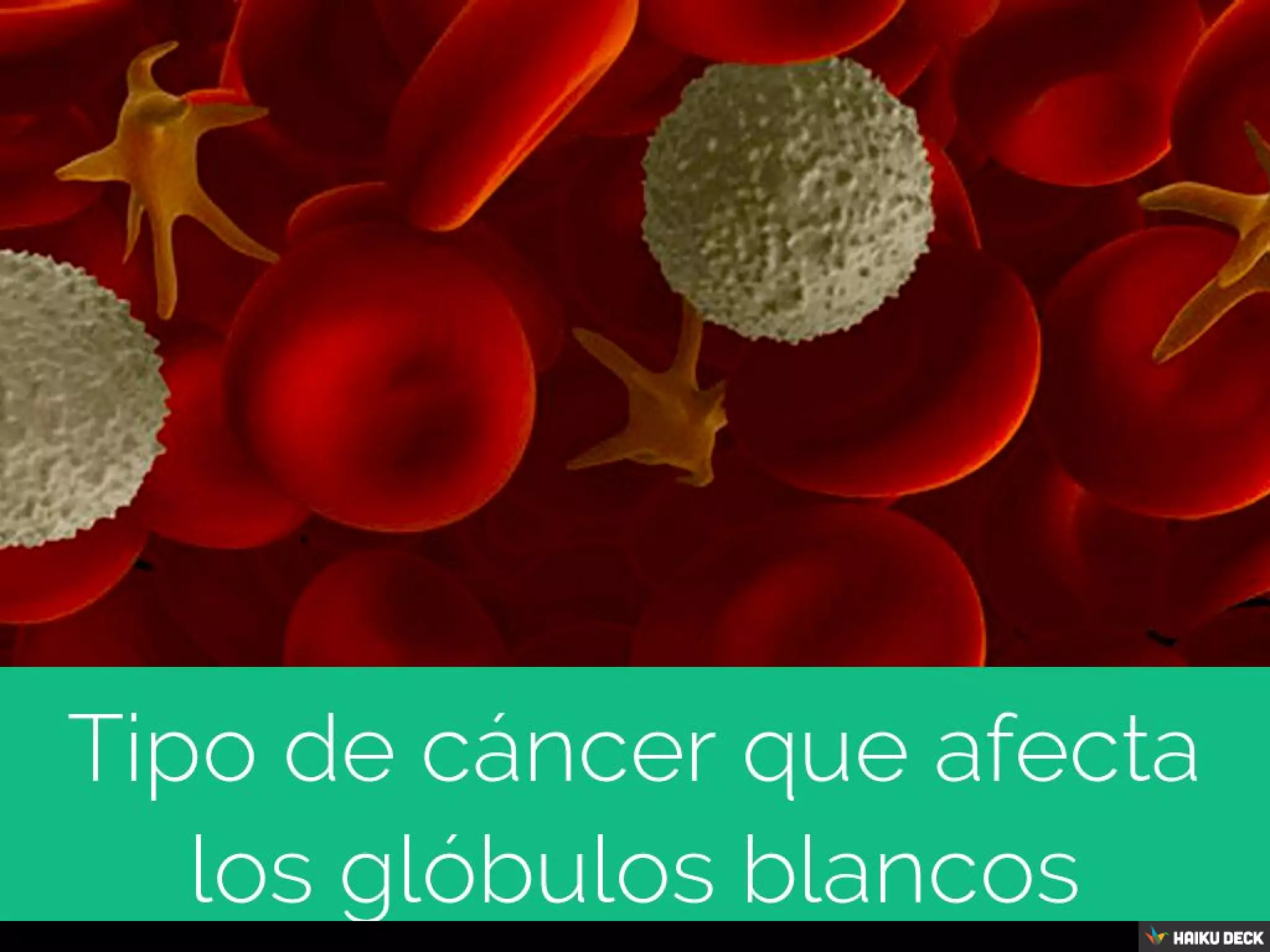 Leucemia Mielomonocitica | PDF