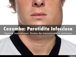 Caxumba | PDF