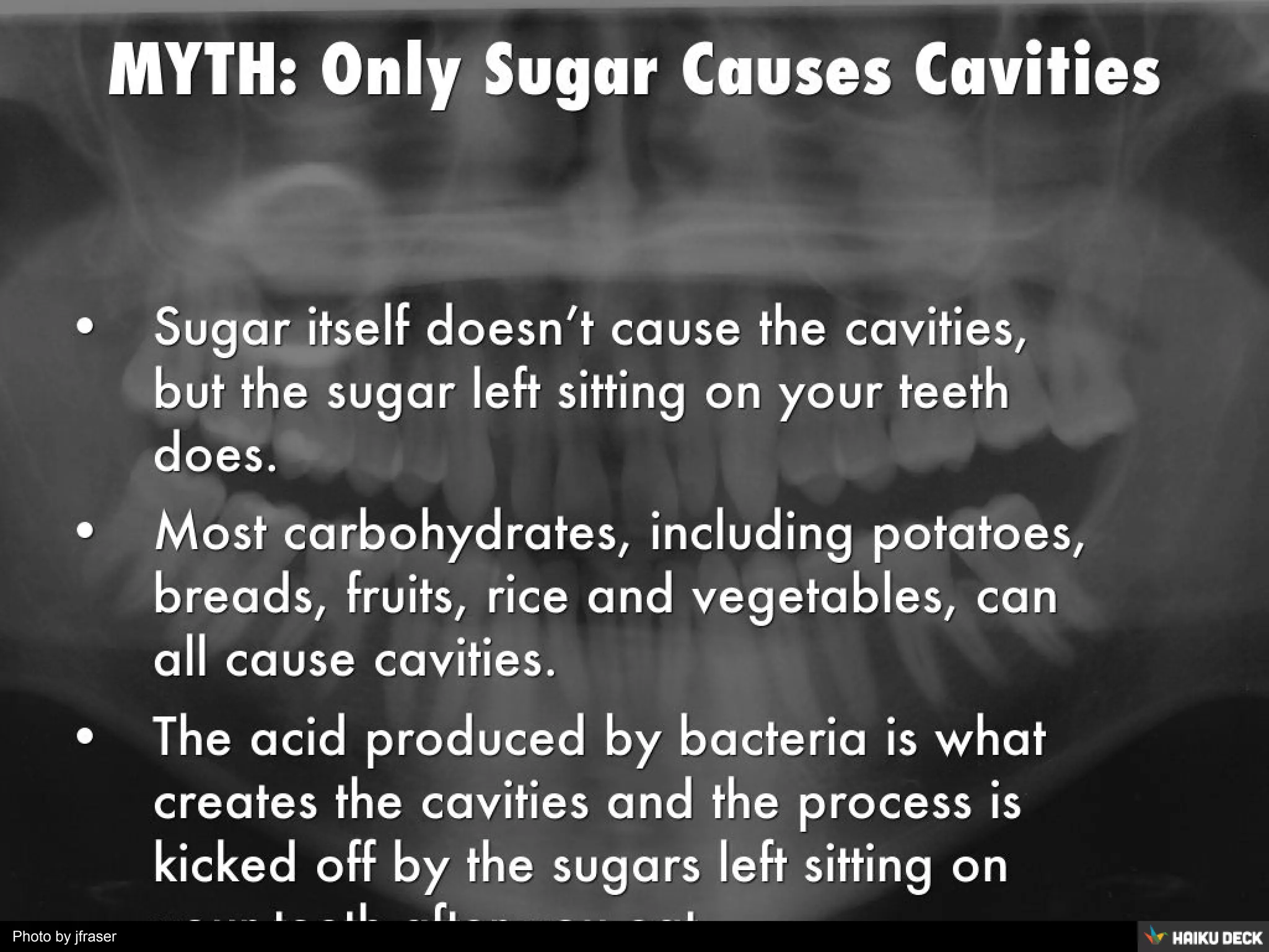 4 Dental Myths and Facts | PPT