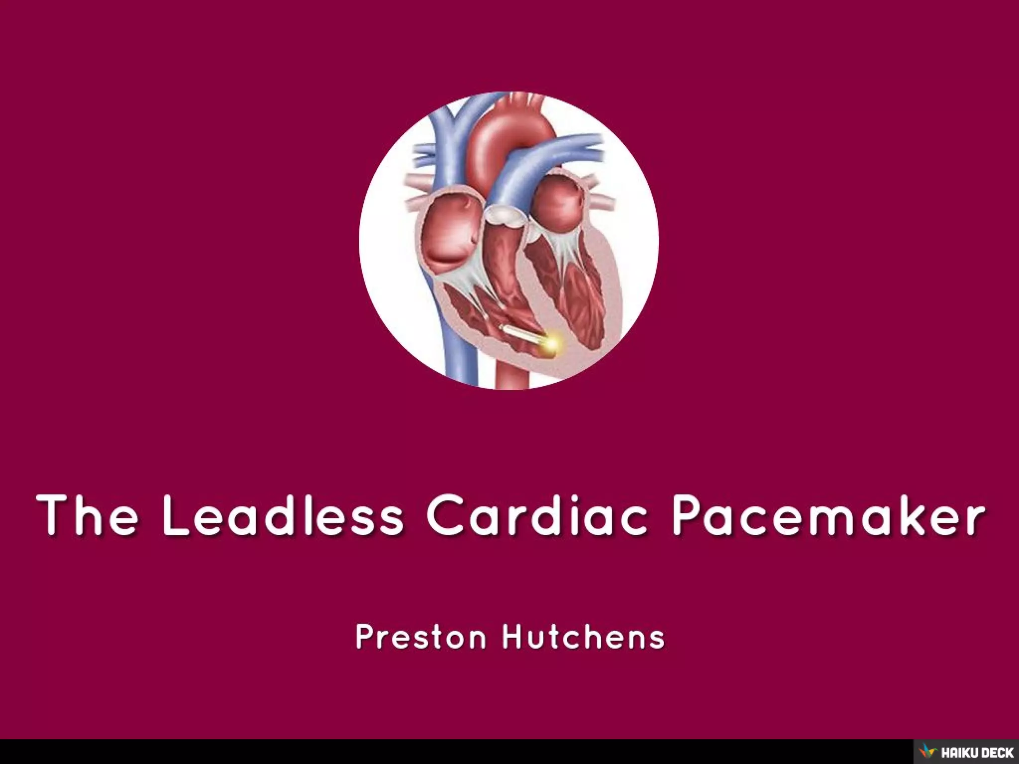 The Leadless Cardiac Pacemaker | PDF