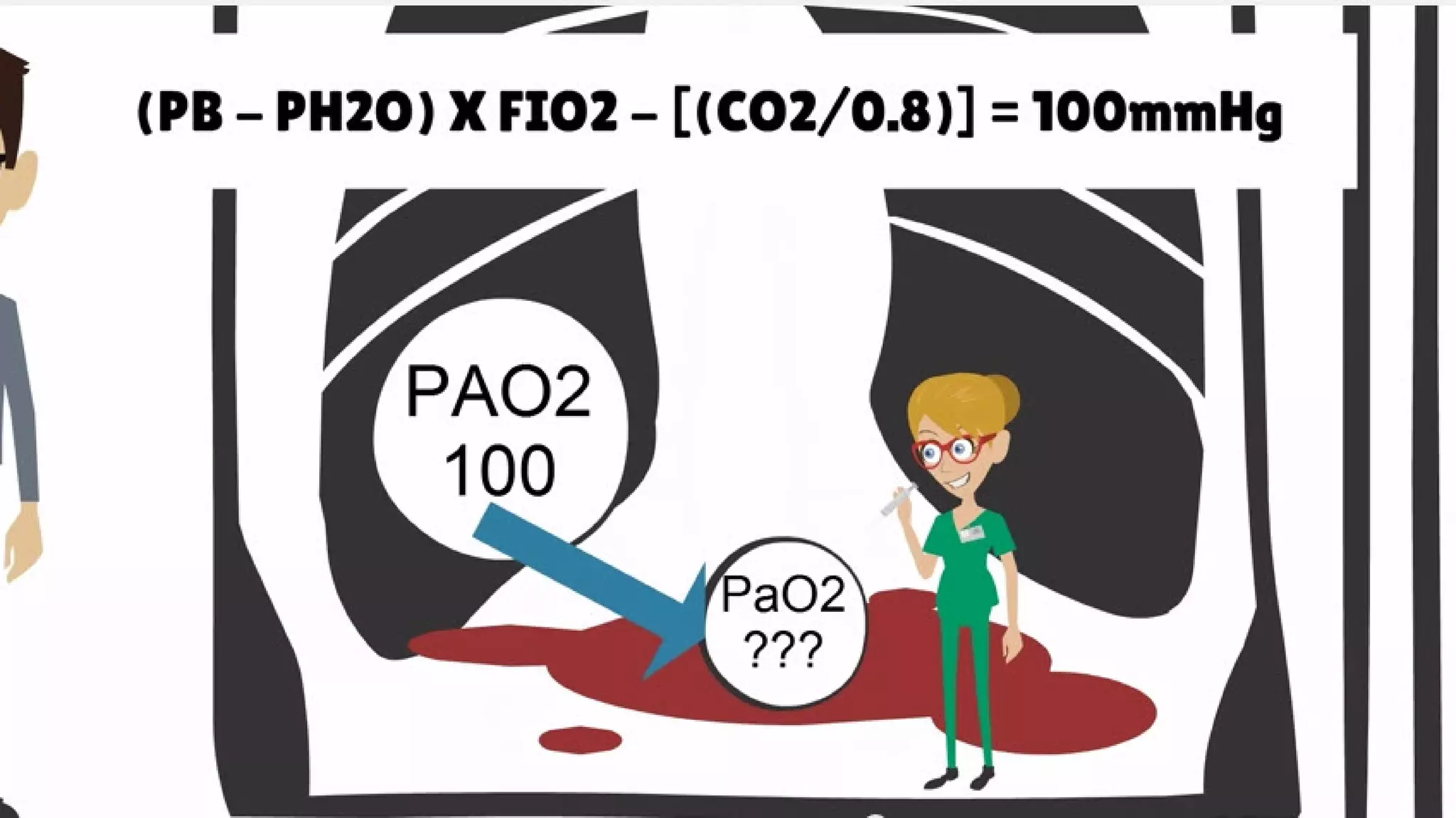 A-a Gradient simplified | PDF