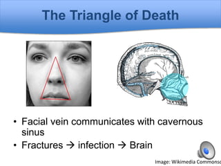 A Brief Introduction to Neuroanatomy: The Great Vessels | PPT