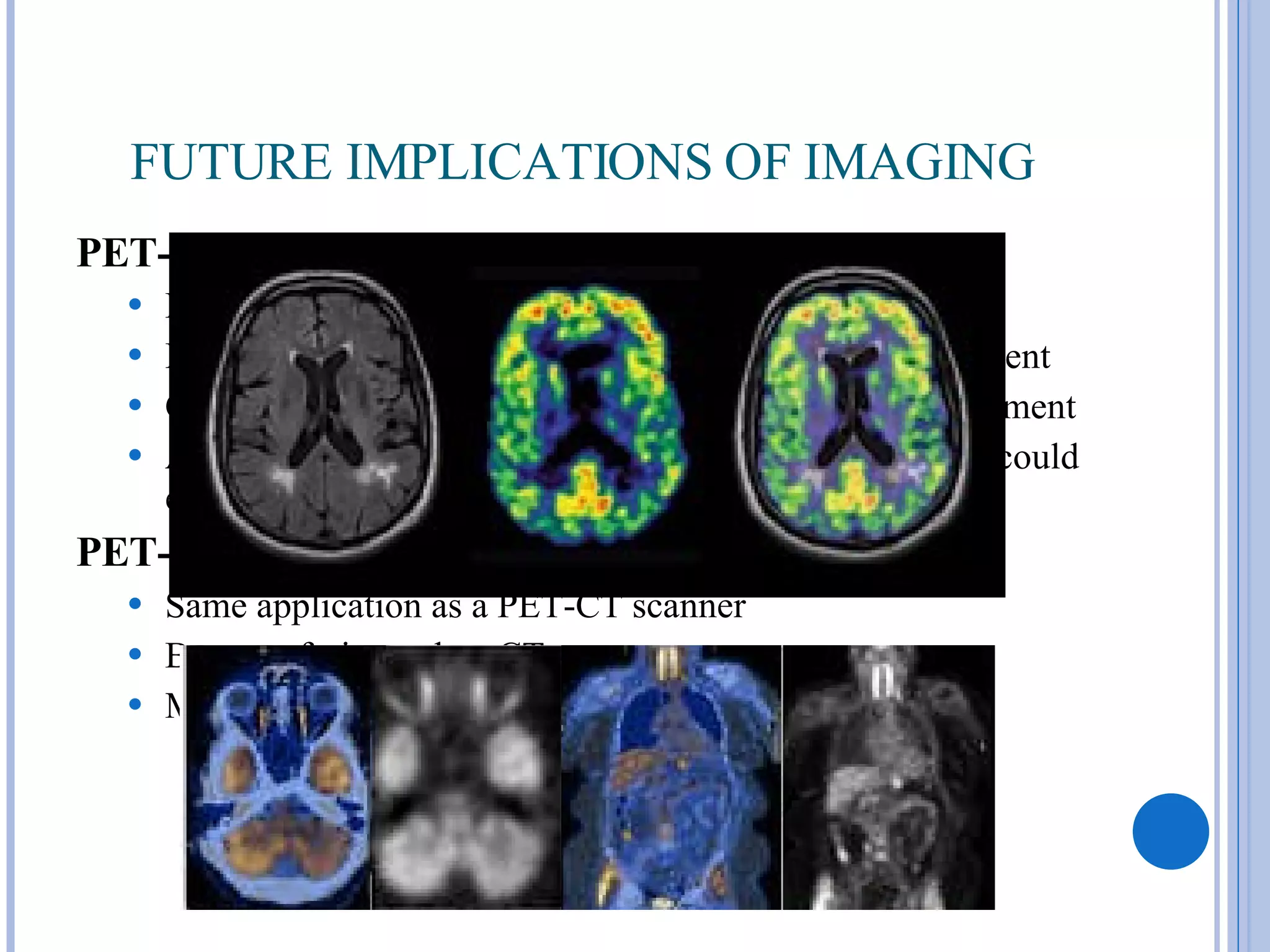 A Closer Look Into Optic Nerve Gliomas | PPT