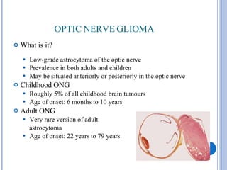 A Closer Look Into Optic Nerve Gliomas | PPT