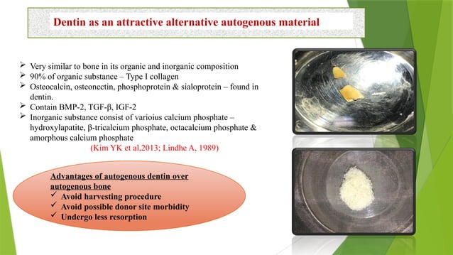 Alveolar ridge preservation with dentin autogenous bone graft | PPT