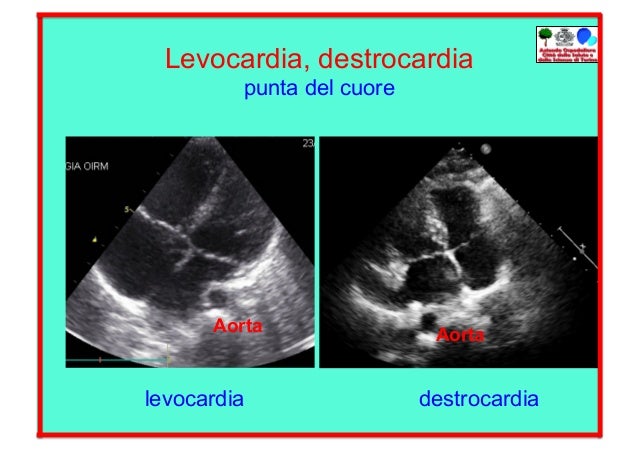 I Corso GUCH: Il cuore normale