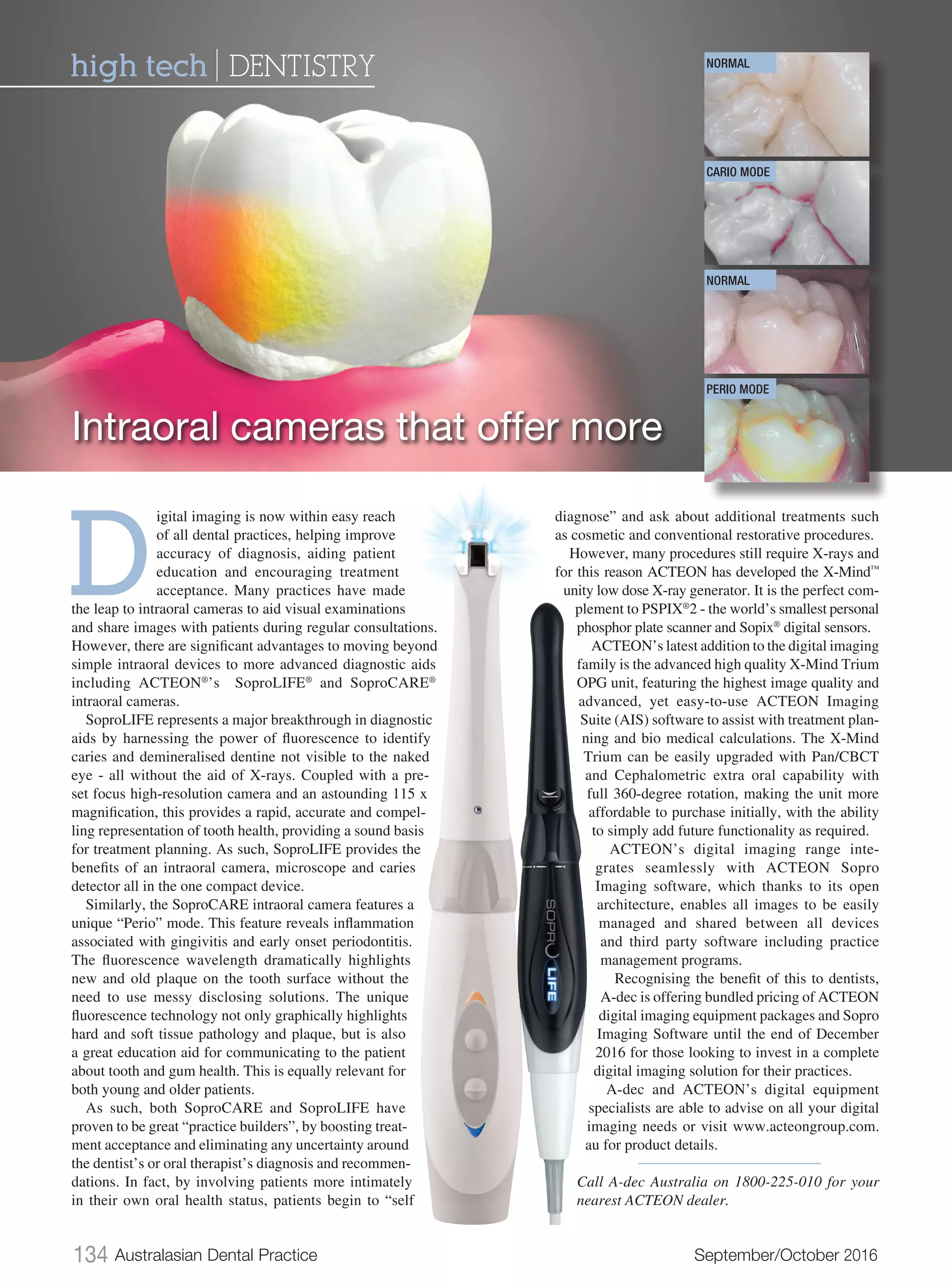Intra Oral Cameras that offer more | PDF