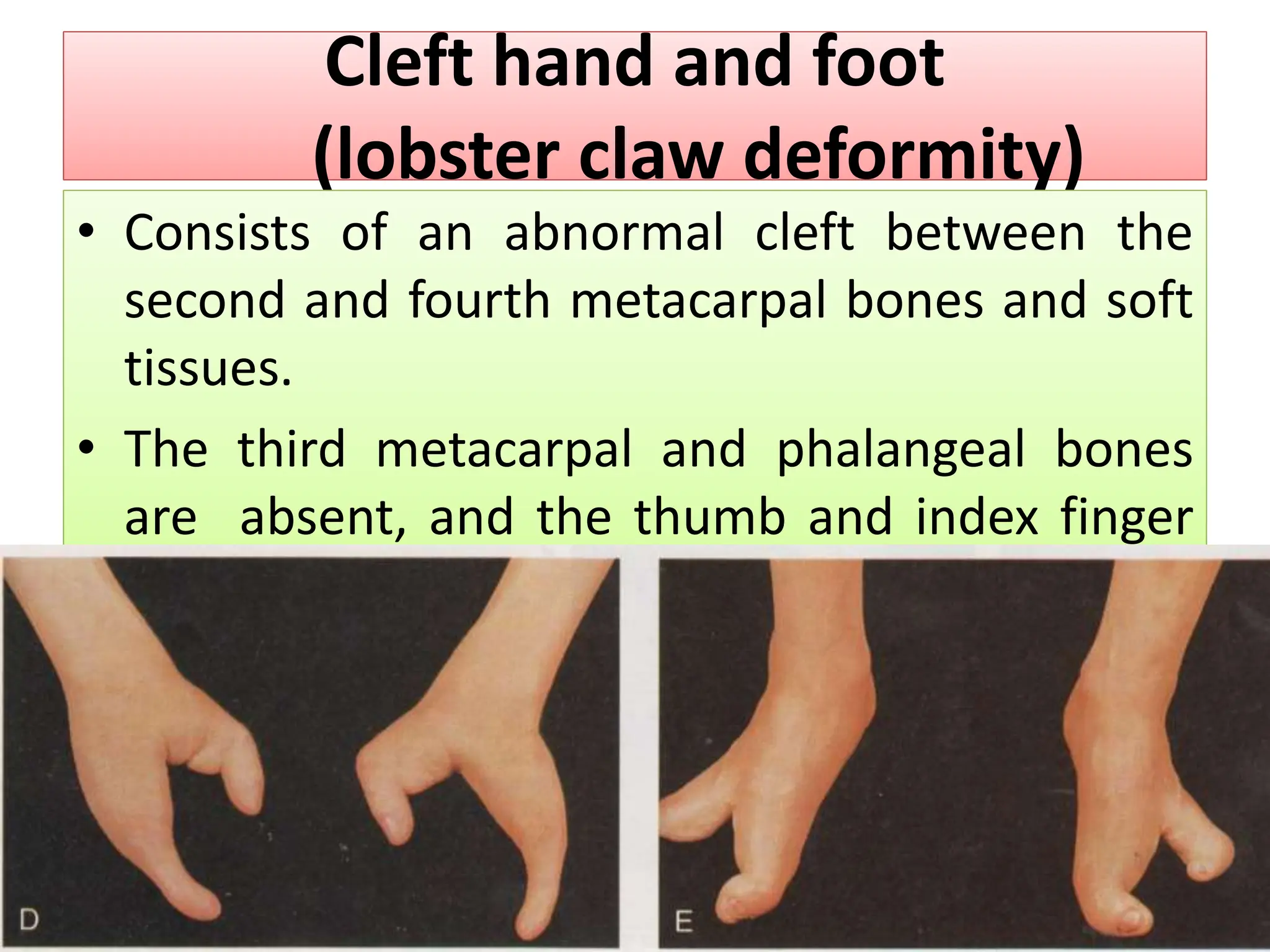 A-Development_of_Upper_Limb-16-12-14.ppt