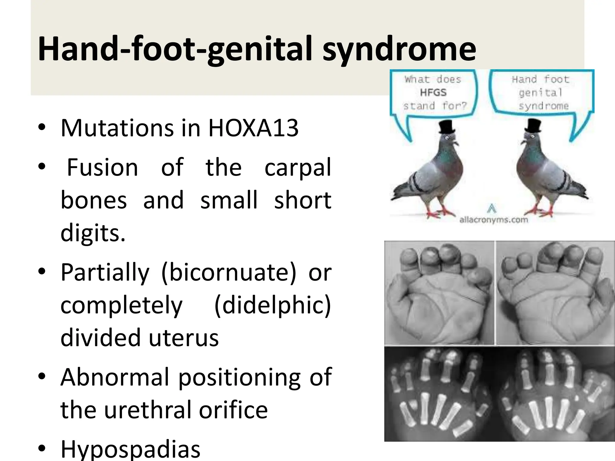 A-Development_of_Upper_Limb-16-12-14.ppt