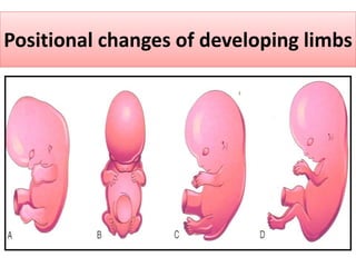 A-Development_of_Upper_Limb-16-12-14.ppt