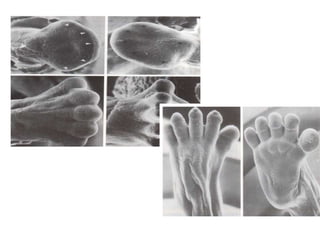 A-Development_of_Upper_Limb-16-12-14.ppt