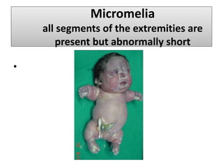A-Development_of_Upper_Limb-16-12-14.ppt