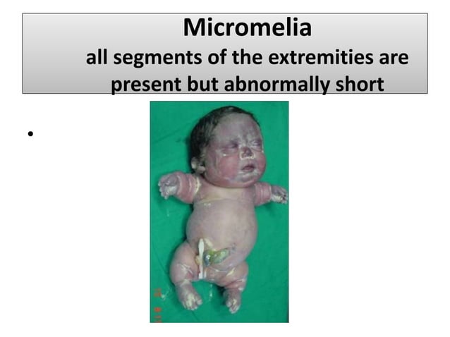 A-Development_of_Upper_Limb-16-12-14.ppt | Pregnancy | Reproductive Health