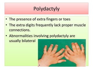 A-Development_of_Upper_Limb-16-12-14.ppt