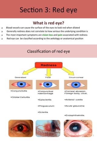 A medical student guide to Red Eye | PDF