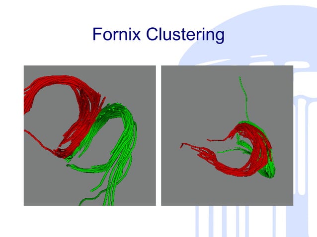 A Quantitative Dti Fiber Tract Analysis Suite 898 Ppt