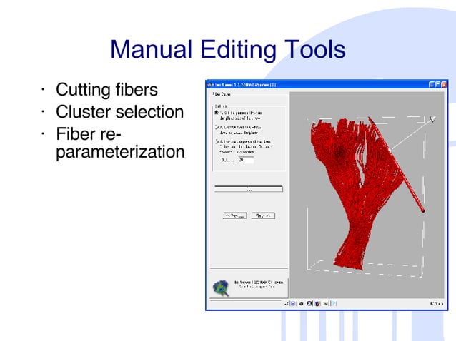 A Quantitative Dti Fiber Tract Analysis Suite 898 Ppt