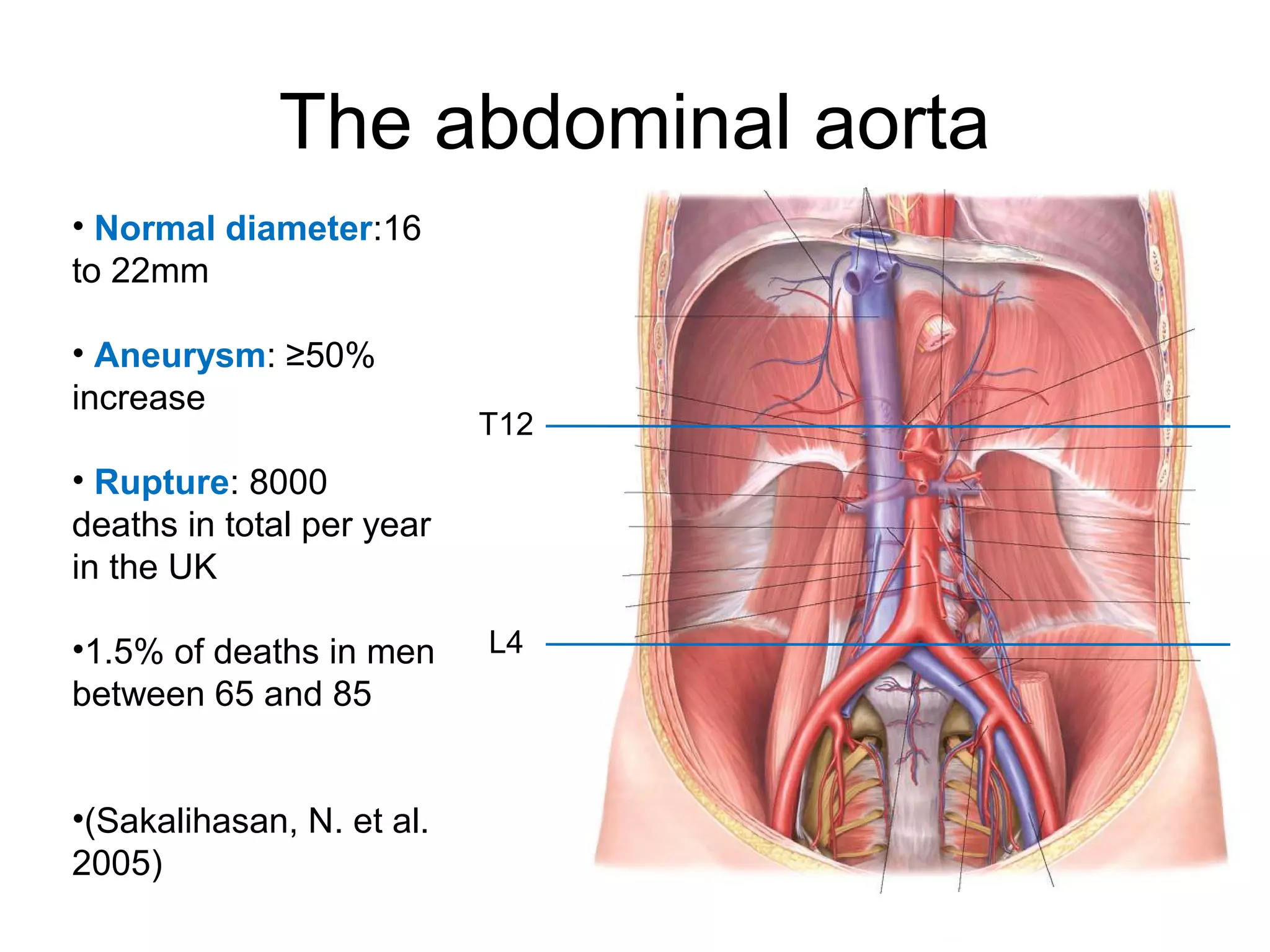 a rough guide to abdominal aortic aneurysms | PPT | Heart and Cardiovascular Diseases | Diseases ...
