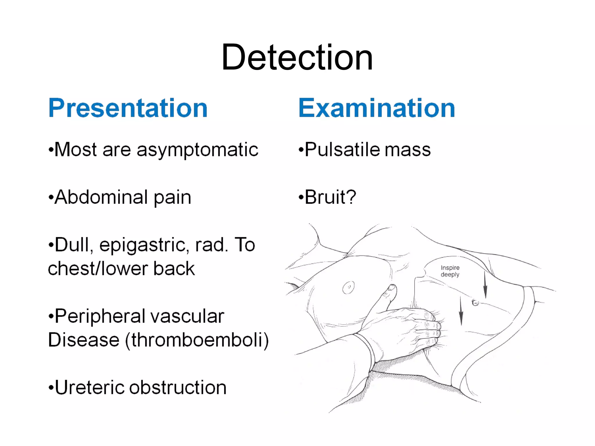 a rough guide to abdominal aortic aneurysms | PPT | Heart and Cardiovascular Diseases | Diseases ...