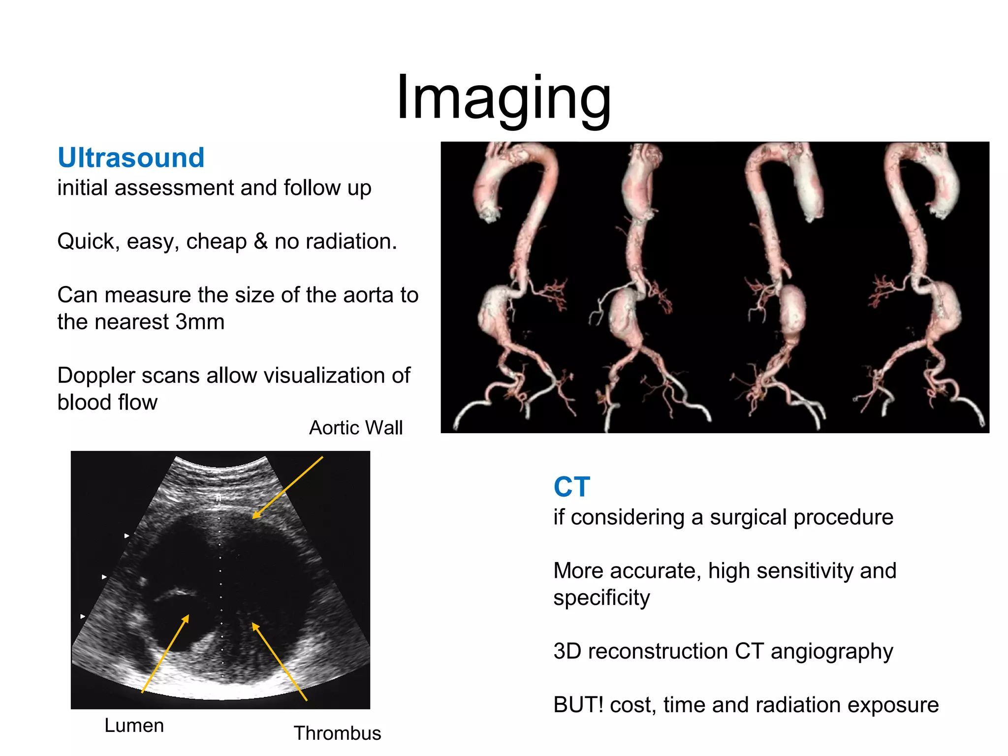 a rough guide to abdominal aortic aneurysms | PPT | Heart and Cardiovascular Diseases | Diseases ...