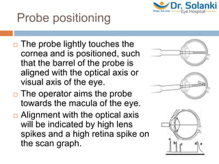 A scan biometry | PPTX