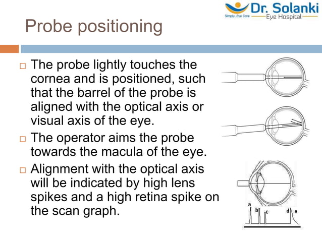 A scan biometry | PPTX