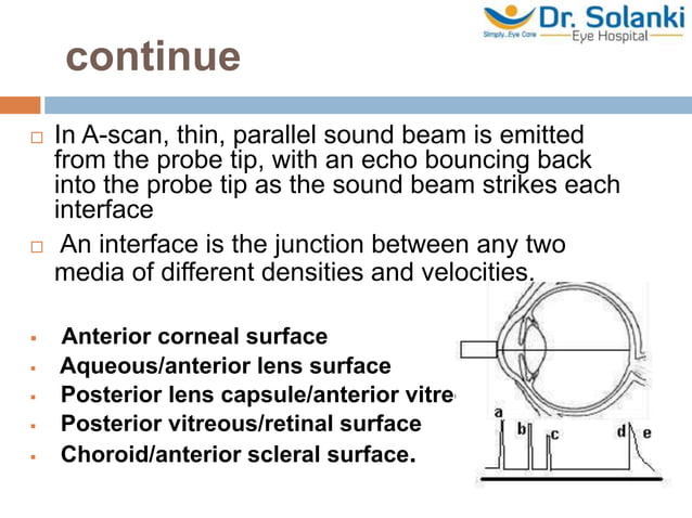 A scan biometry | PPTX