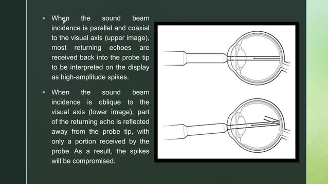 A scan | PPTX | Eye and Vision Conditions | Diseases and Conditions