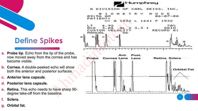 A scan biometry | How to Use A-scan? Types of A-Scan Biometry? | PDF