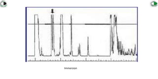 A-Scan Biometry.pptx