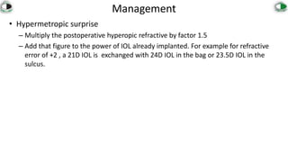 A-Scan Biometry.pptx
