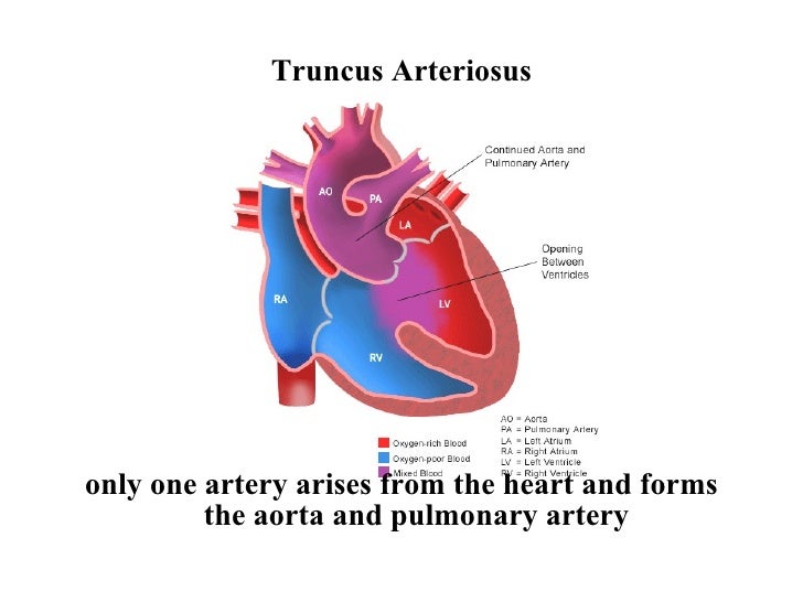 Truncus Arteriosus only one artery