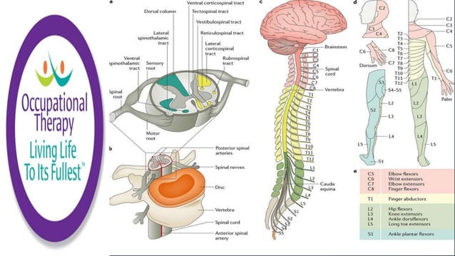 Occupational Therapy Management of Sensory Dysfunction & Oedema | PPTX ...