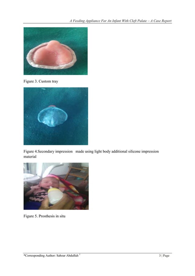 A Feeding Appliance for an Infant with Cleft Palate – A Case Report | PDF