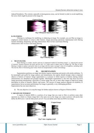 Instant fracture detection using ir-rays | PDF | Photo Editing Software | Computer Software and ...