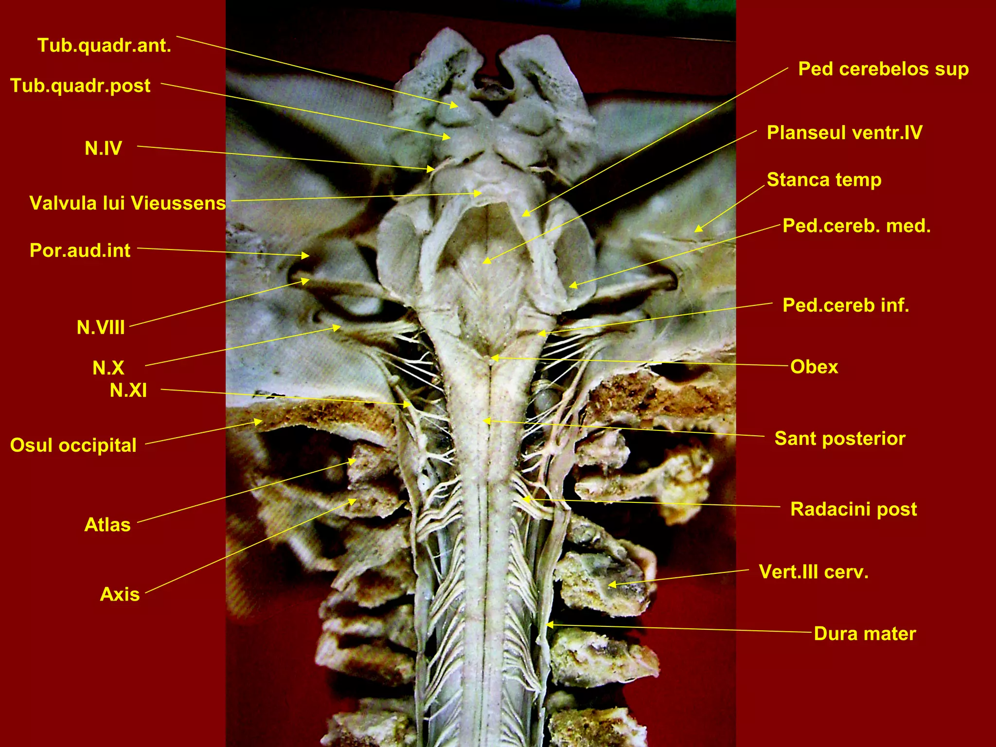 Atlas de neuroanatomie - maduva spinarii | PPT
