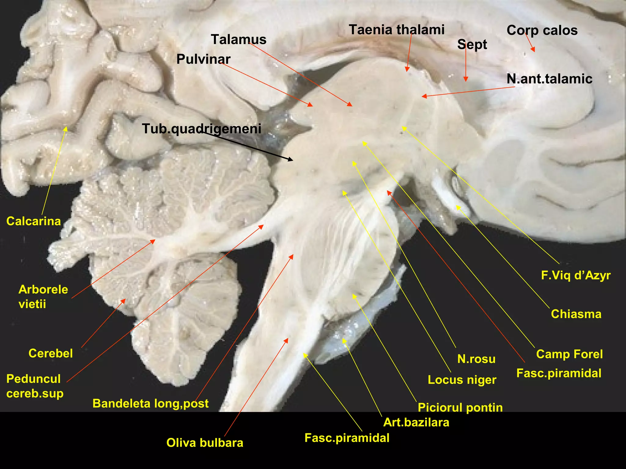 Atlas de neuroanatomie - trunchiul cerebral | PPT