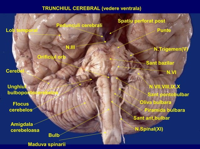 Atlas de neuroanatomie - trunchiul cerebral | PPT