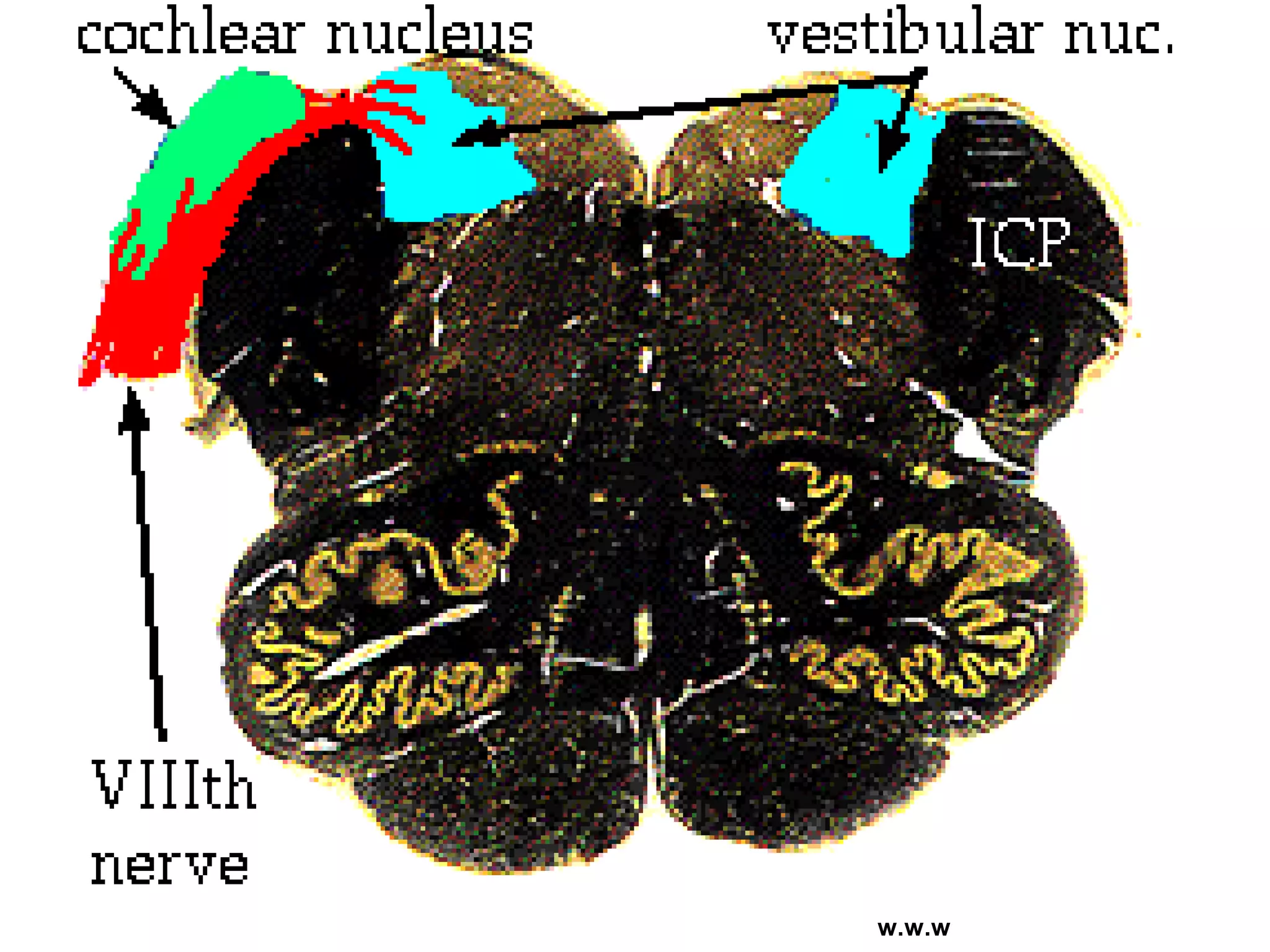 Atlas de neuroanatomie - nervi periferici | PPT