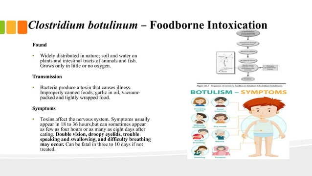 food infection vs food intoxication | PPTX