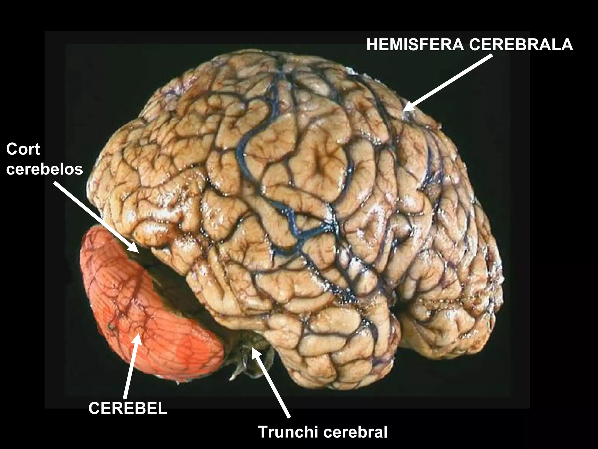 Atlas de neuroanatomie - cerebel | PPT