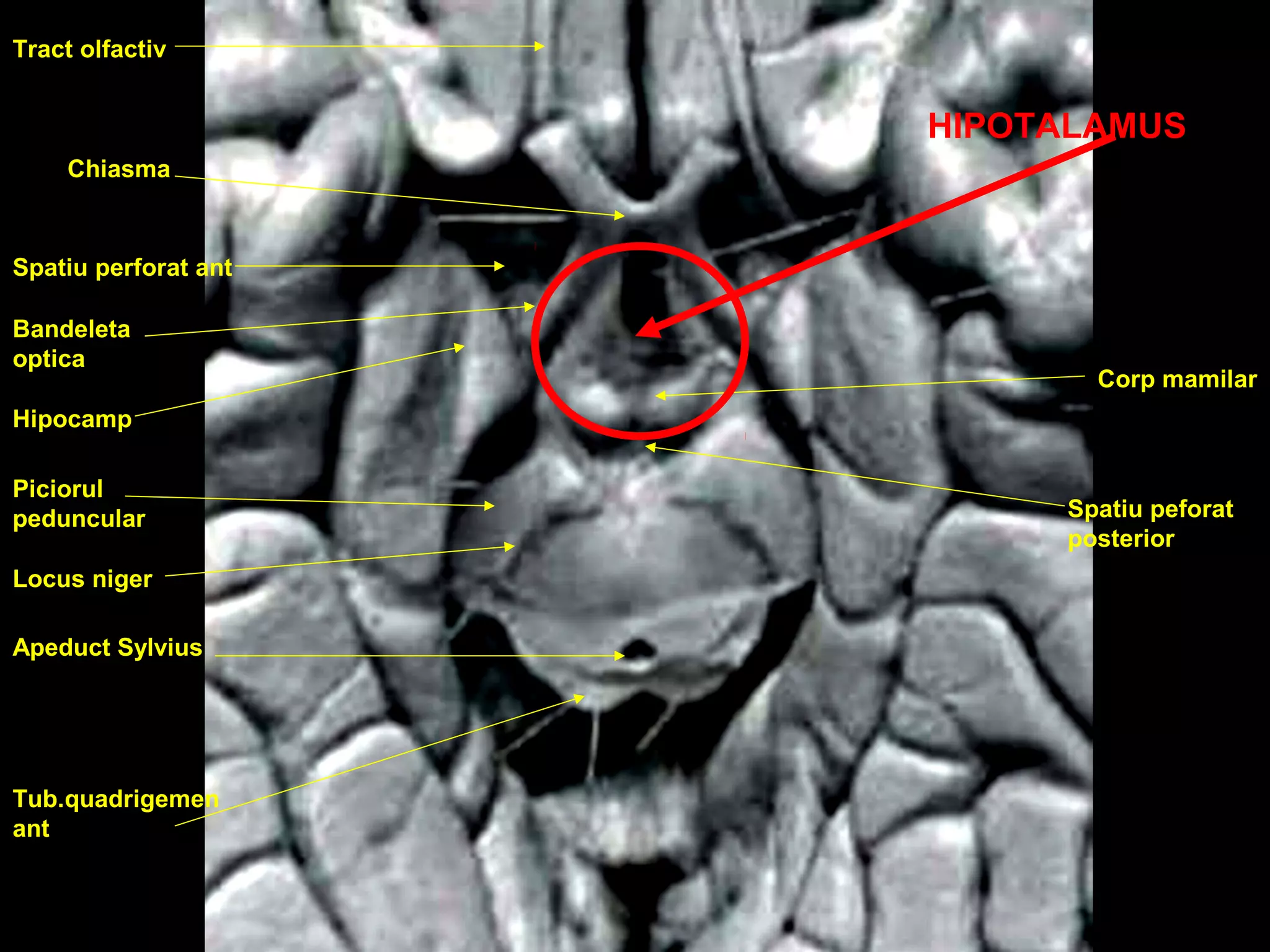 Hipotalamus atlas de neuroanatomie | PPT