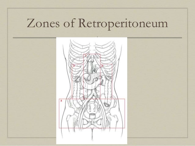 Disease of the Peritoneum and Retroperitoneum