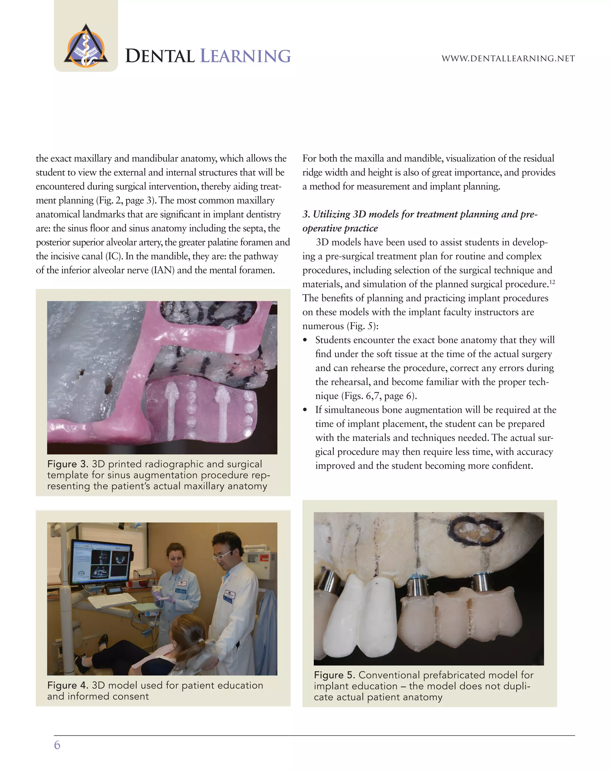 The use of 3D printing in dental implant education | PDF | Dental ...