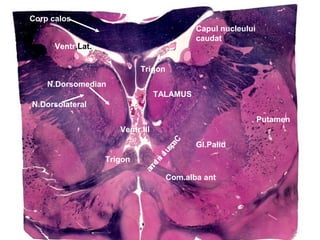 Talamus atlas de neuroanatomie | PPT