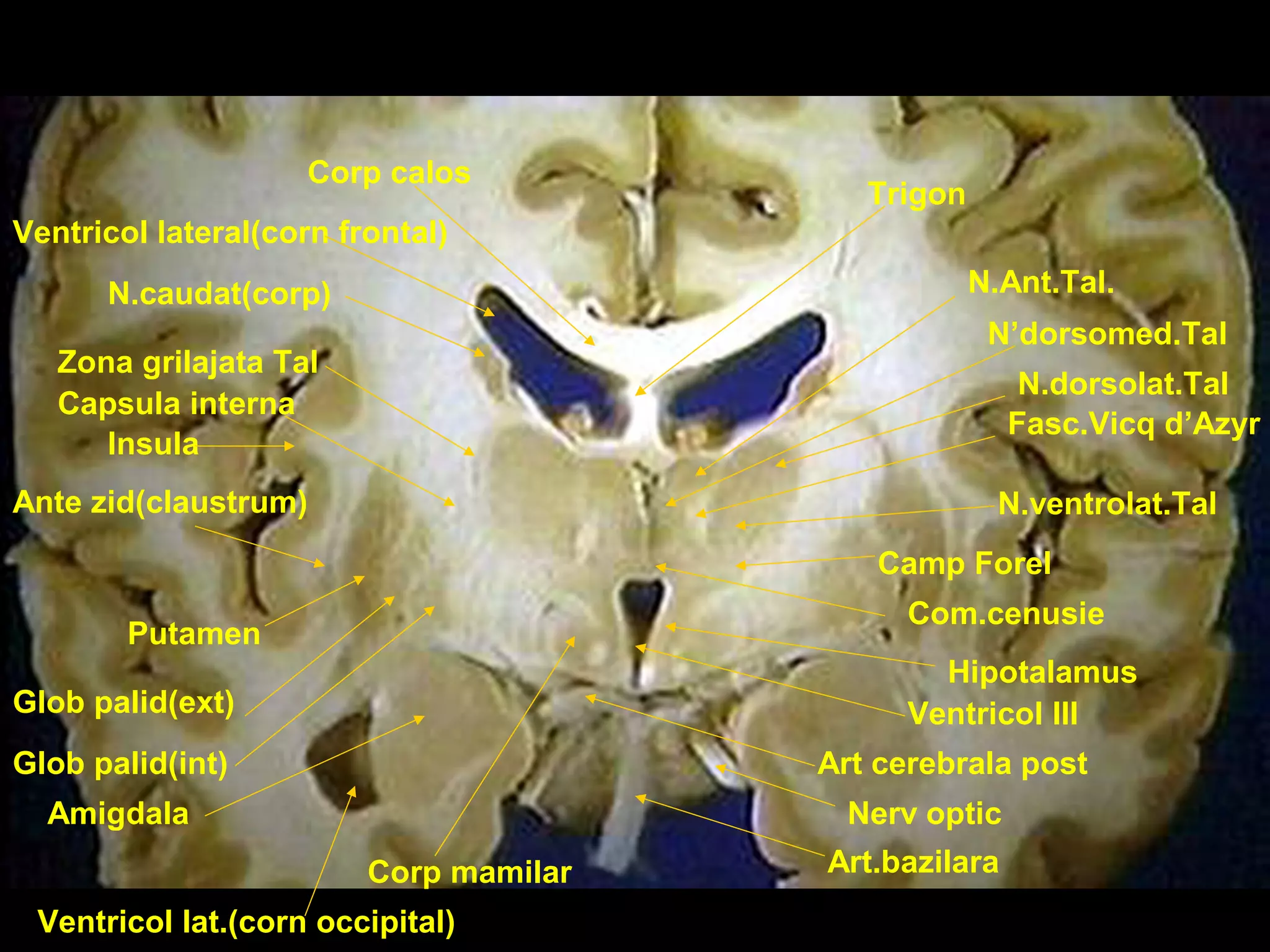 Sistemul extrapiramidal atlas de neuroanatomie | PPT
